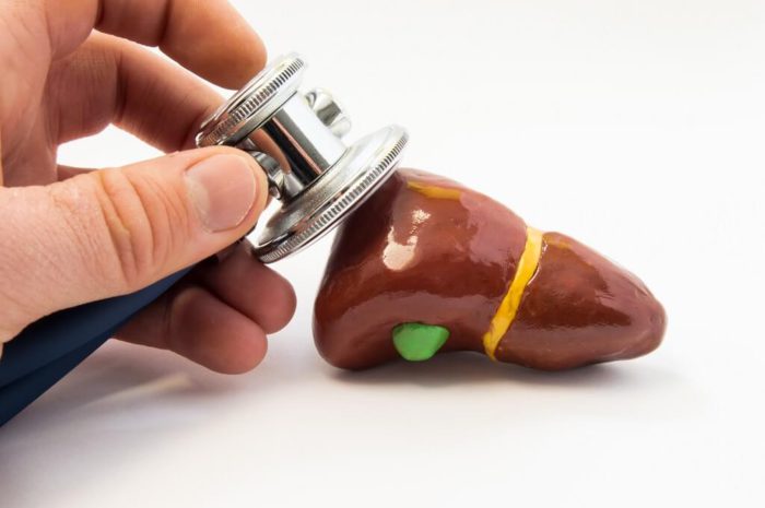 Penyakit Liver: Penyebab, Gejala, Diagnosis & Pengobatan