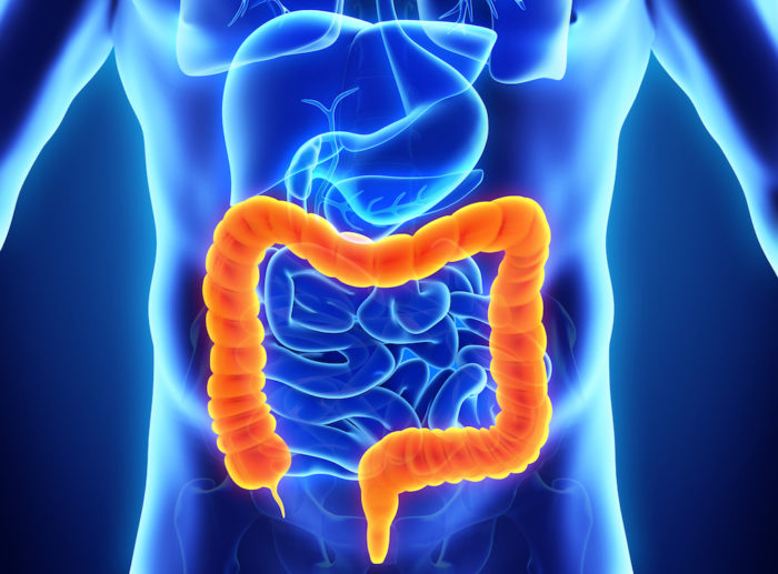 Mengalami Hal Ini? Waspada Usus Bocor