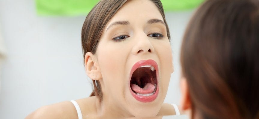 Infeksi Jamur Candidiasis - Ulasan Singkat - DokterSehat