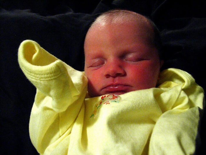 Mengenal Lebih Jauh Apa itu Bayi Kuning