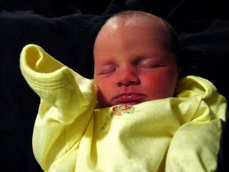 Mengenal Lebih Jauh Apa itu Bayi Kuning