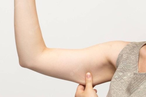 Kenali Ukuran Lingkar Lengan Atas (LILA) Normal pada Ibu Hamil