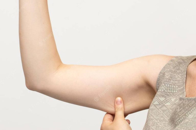 Kenali Ukuran Lingkar Lengan Atas (LILA) Normal pada Ibu Hamil