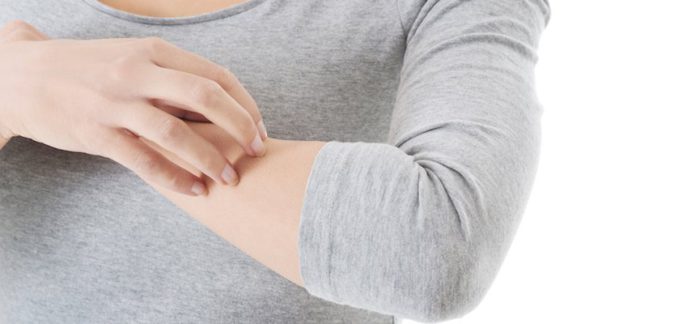 Vaskulitis: Gejala, Penyebab, Pengobatan, dll - DokterSehat