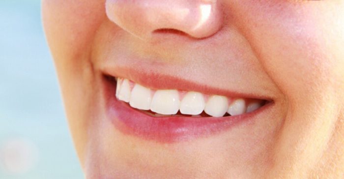 5 Cara Merawat Gigi Tetap Sehat dan Cantik - DokterSehat