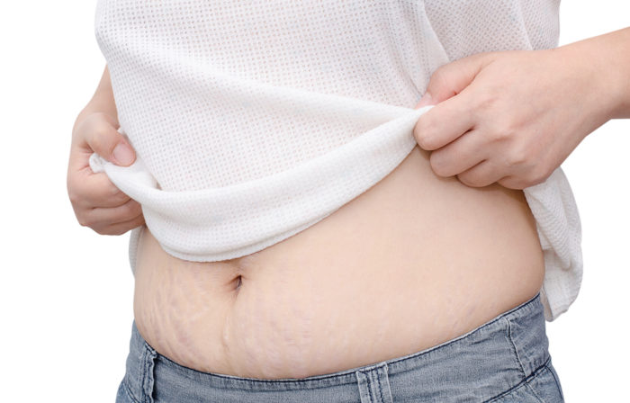 3 Jenis Olahraga yang Efektif Mengusir Perut Buncit