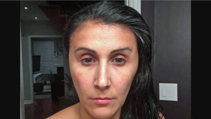 Mewarnai Rambut, Muka Wanita Ini Jadi Mirip Alien