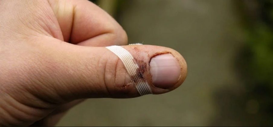 Tetanus: Penyebab, Gejala, Pengobatan, dan Pencegahan