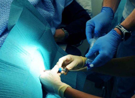 Biopsi: Pengertian, Jenis, Efek Samping