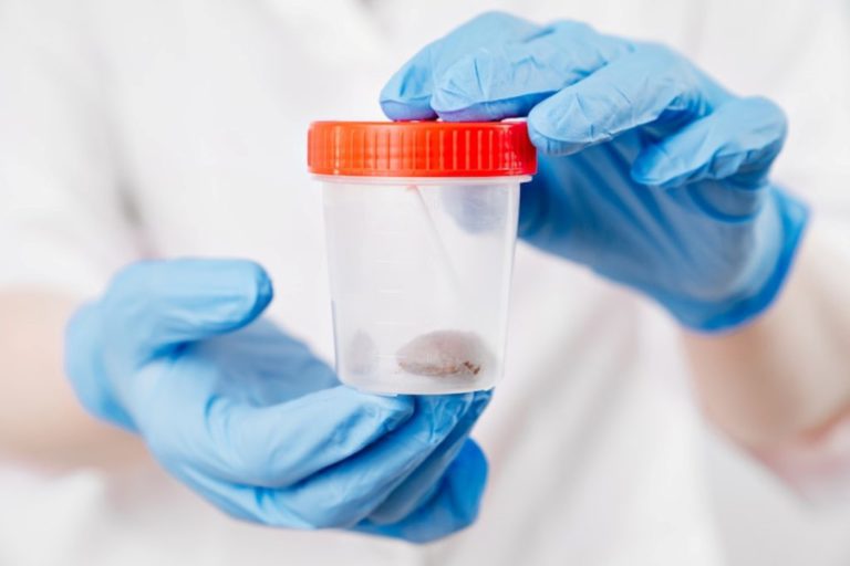 Pemeriksaan Feses Lengkap: Fungsi, Prosedur & Nilai Normal