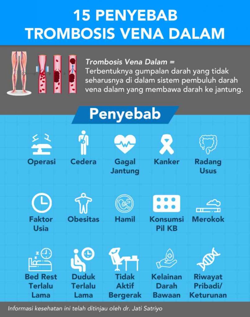 15 Penyebab Trombosis Vena Dalam (DVT) - DokterSehat