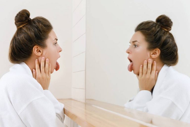8 Cara Mengobati Amandel (Tonsillitis) di Rumah