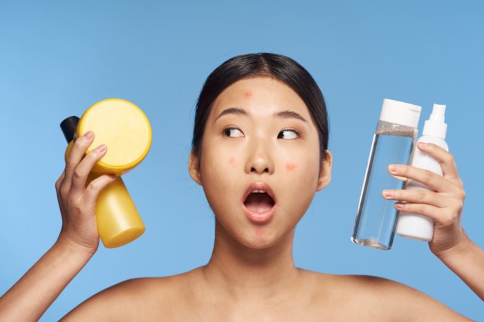 Mengenal Purging dan Bedanya dengan Jerawat Biasa - DokterSehat