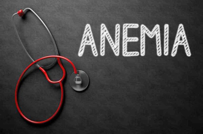 Anemia Gravis: Gejala, Penyebab, Pengobatan, dll