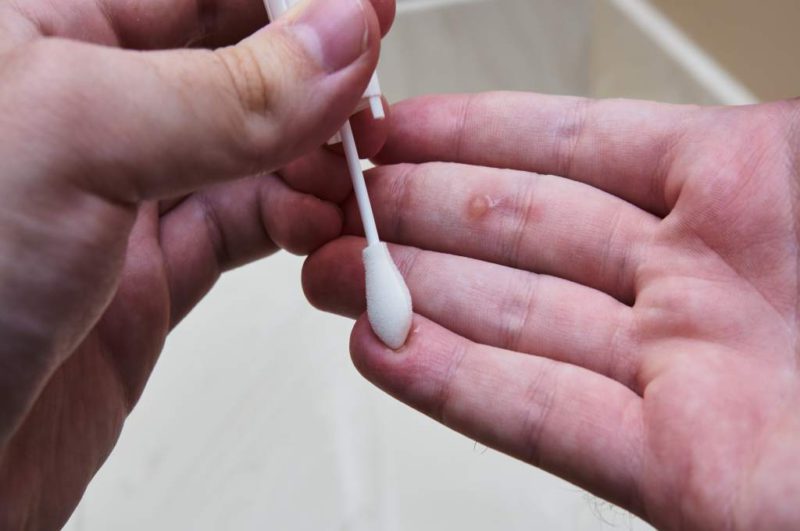 14 Cara Menghilangkan Kutil dengan Bahan Alami - DokterSehat