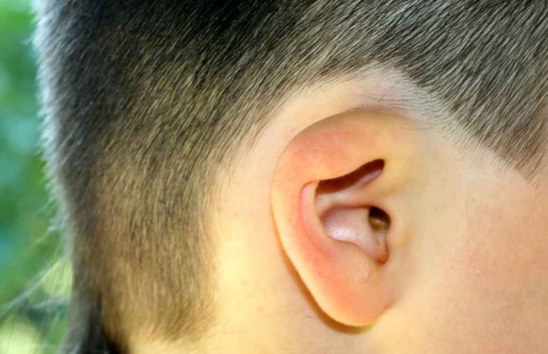 Cauliflower Ear: Gejala, Penyebab, Cara Mengobati, dll - DokterSehat