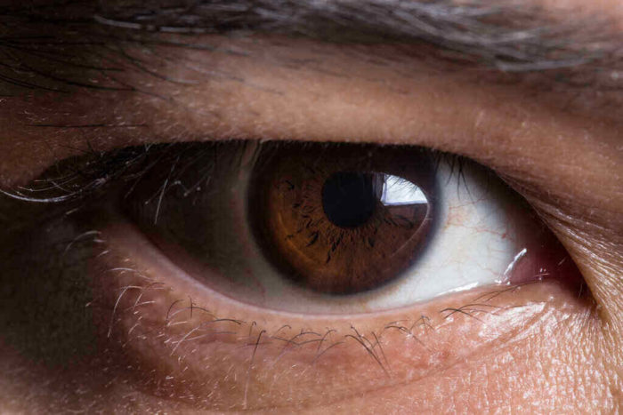 Floppy Eyelid Syndrome: Gejala, Penyebab, Pengobatan - DokterSehat
