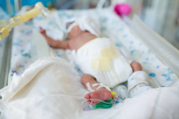 Terapi Surfaktan: Fungsi, Prosedur, Komplikasi, dll - DokterSehat