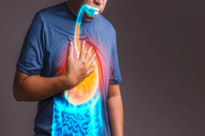 Esomeprazole: Manfaat, Dosis, Efek Samping, dll