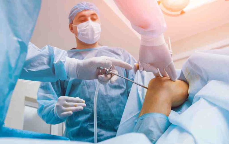 Artroskopi: Fungsi, Prosedur, Komplikasi, Waktu Pemulihan, dll