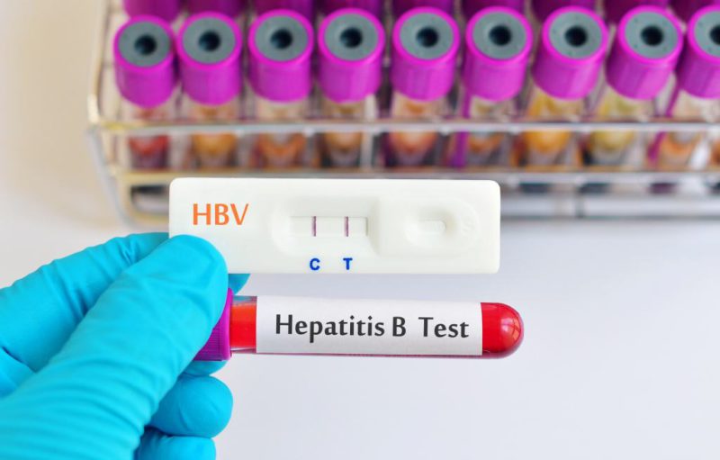 HBsAg, Tes Darag untuk Memastikan Hepatitis B - DokterSehat