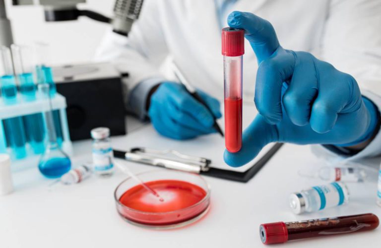 Pemeriksaan D-dimer: Fungsi, Prosedur, Risiko, dll