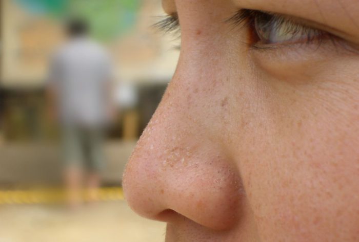 Penyebab Hidung Berkeringat dan Cara Mengatasinya - DokterSehat