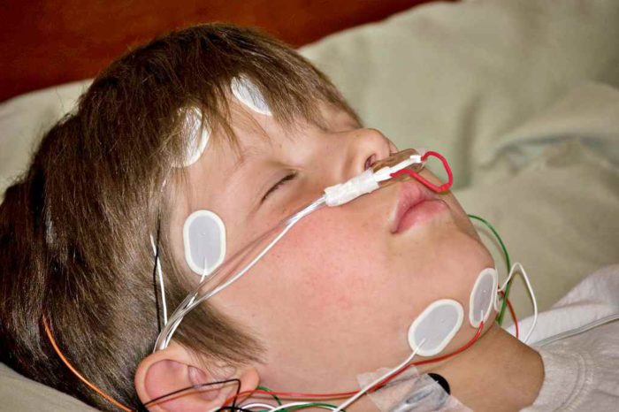 Polisomnografi (Sleep Study): Fungsi, Prosedur, & Cara Membaca Hasil